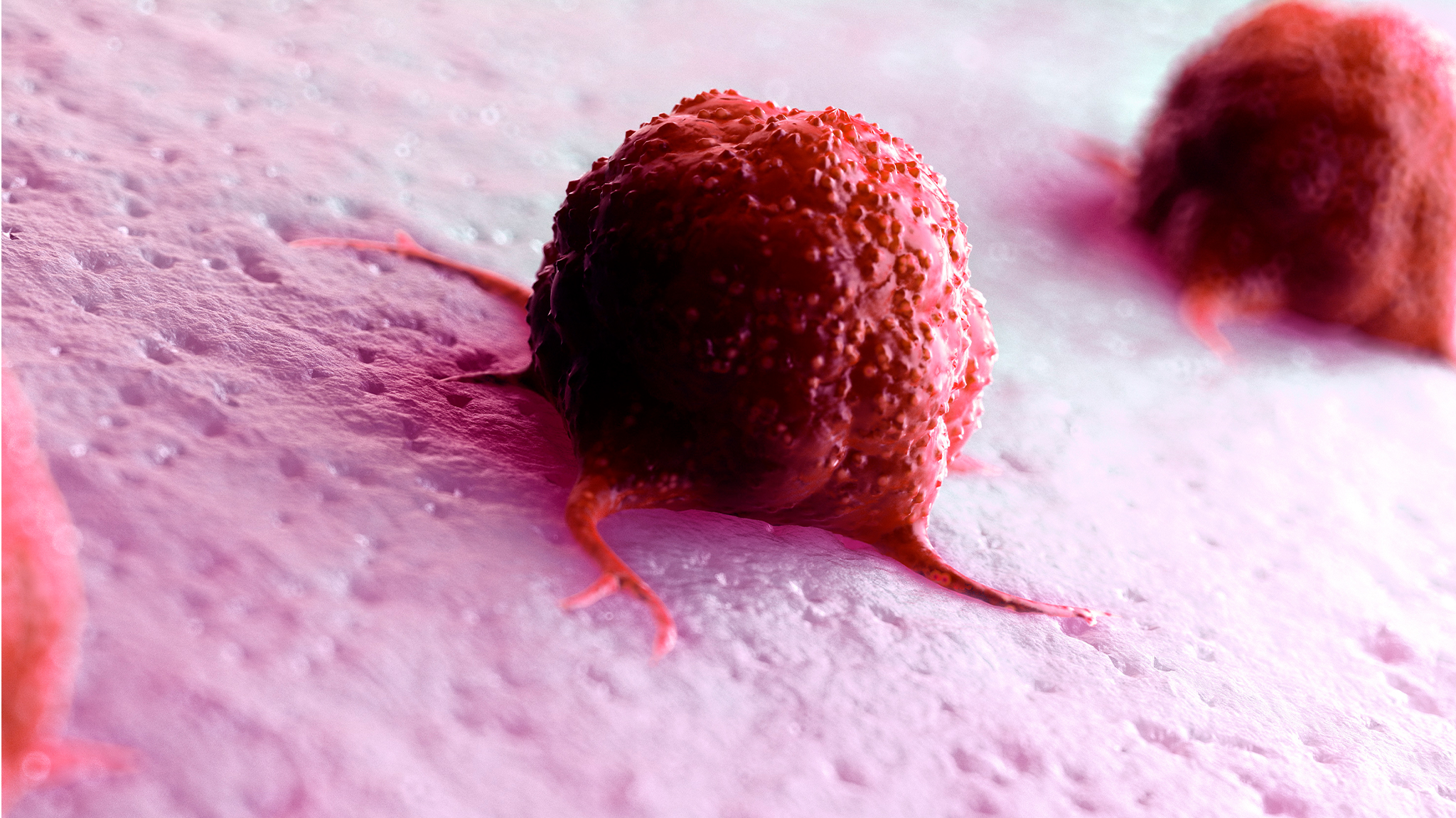 Project Oncology® - Global Oncology Academy
